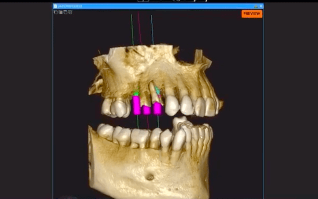 Tac dental 3d - Clínica dm dental